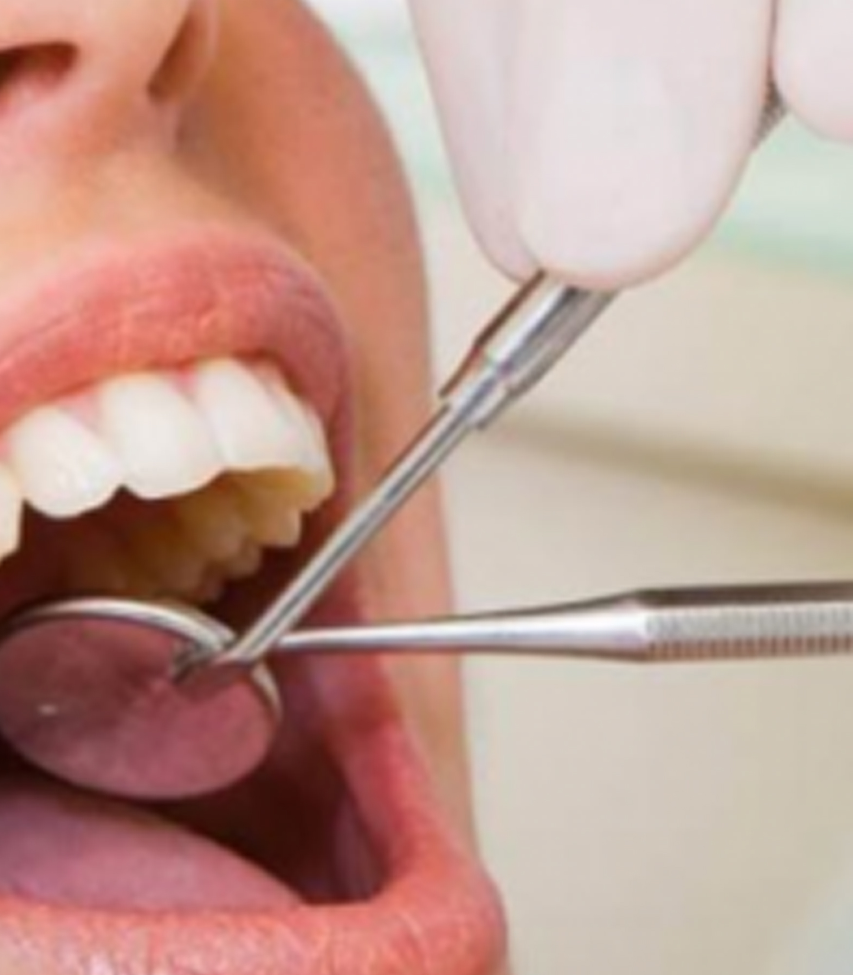 The Importance of Oral Cancer Screenings - Boyett Family Dentistry